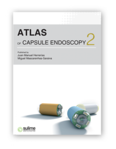 Atlas of capsule endoscopy 2 – Sulime Diseño de Soluciones